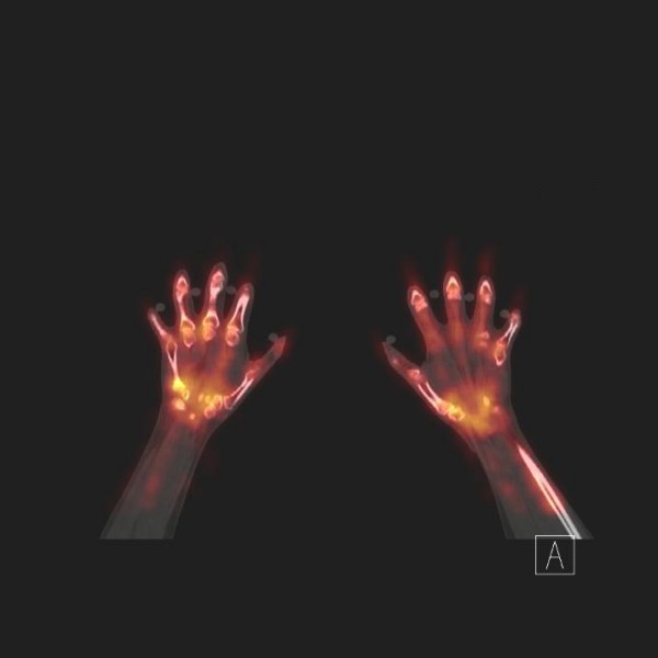 Hand Support “superman position” – Patient positioning – Southern ...